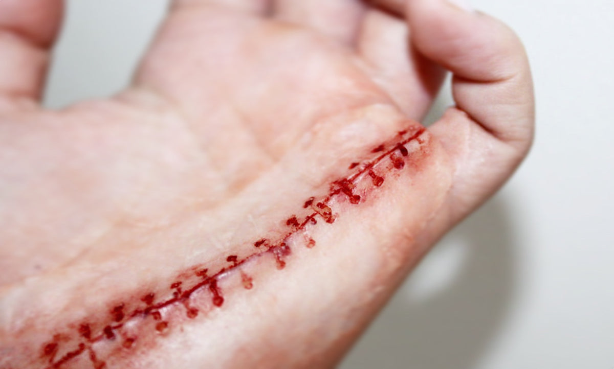 Opened Stitches Prosthetic – ForensicFX Studios